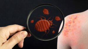 Cum recunoști mușcătura de ploșniță și cum o tratezi